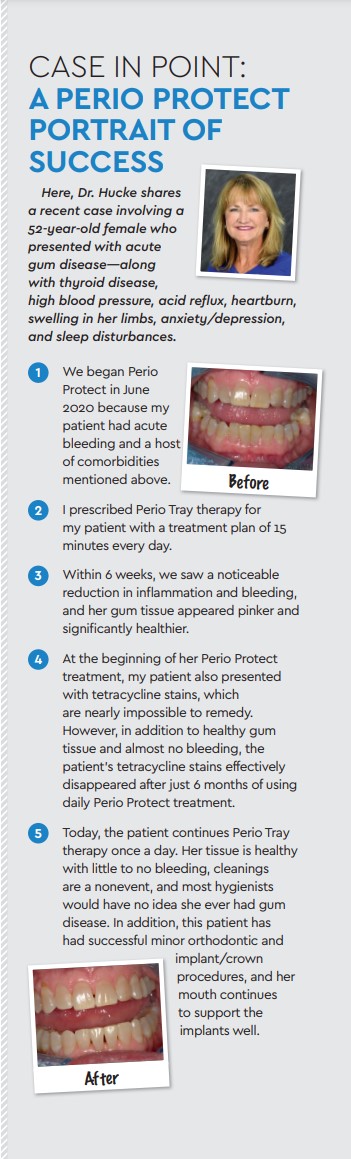 Non-Invasive Treatment for | DPS