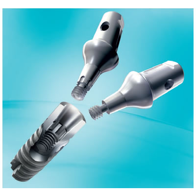 ANKYLOS Implant System | Dentsply Sirona