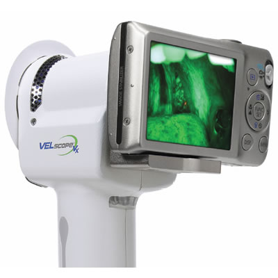 VELscope Vx | Led Dental Inc.