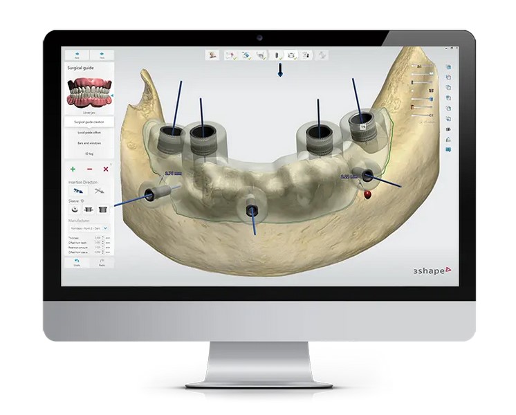 3Shape Products | Dental Product Shopper