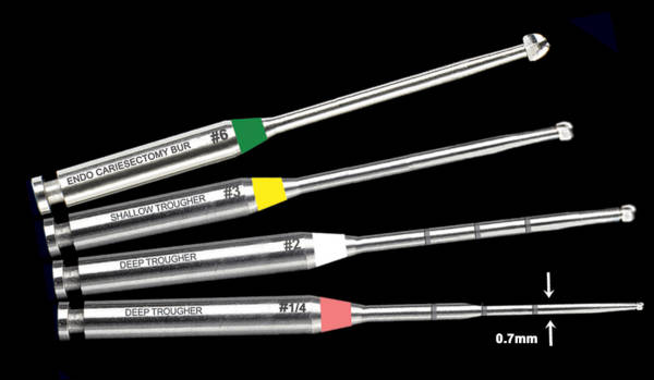 Munce Discovery Burs | Cjm Engineering, Inc | Product Review