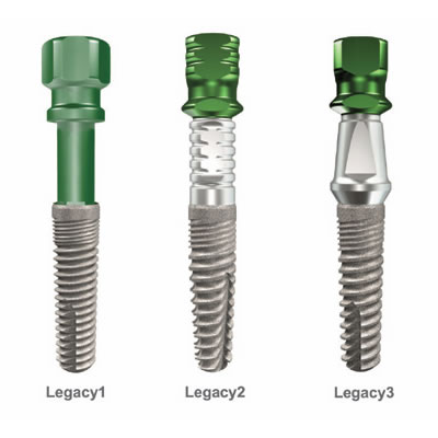 LEGACY SYSTEM | Implant Direct