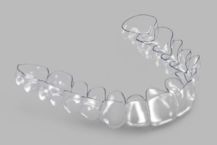 Smilers Aligners | DPS | DPS