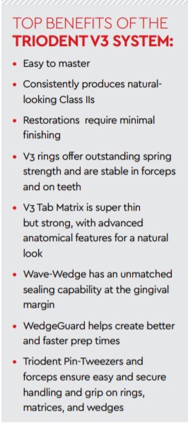 Making Class II Restorations a | DPS