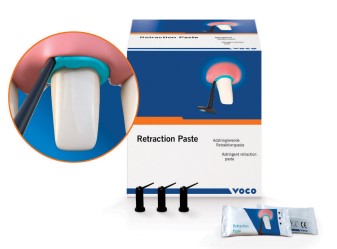 VOCO Retraction Paste | DPS | DPS